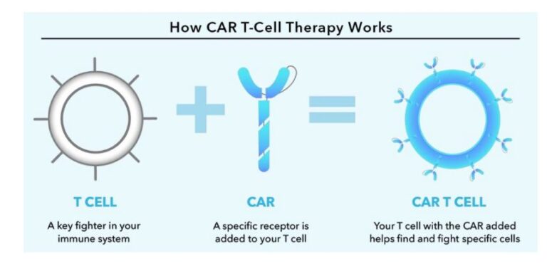 How does CAR-T cell therapy work, and why is it so expensive ...